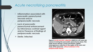 Pancreatitis | PPT