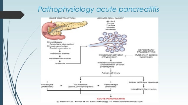 Pancreatitis