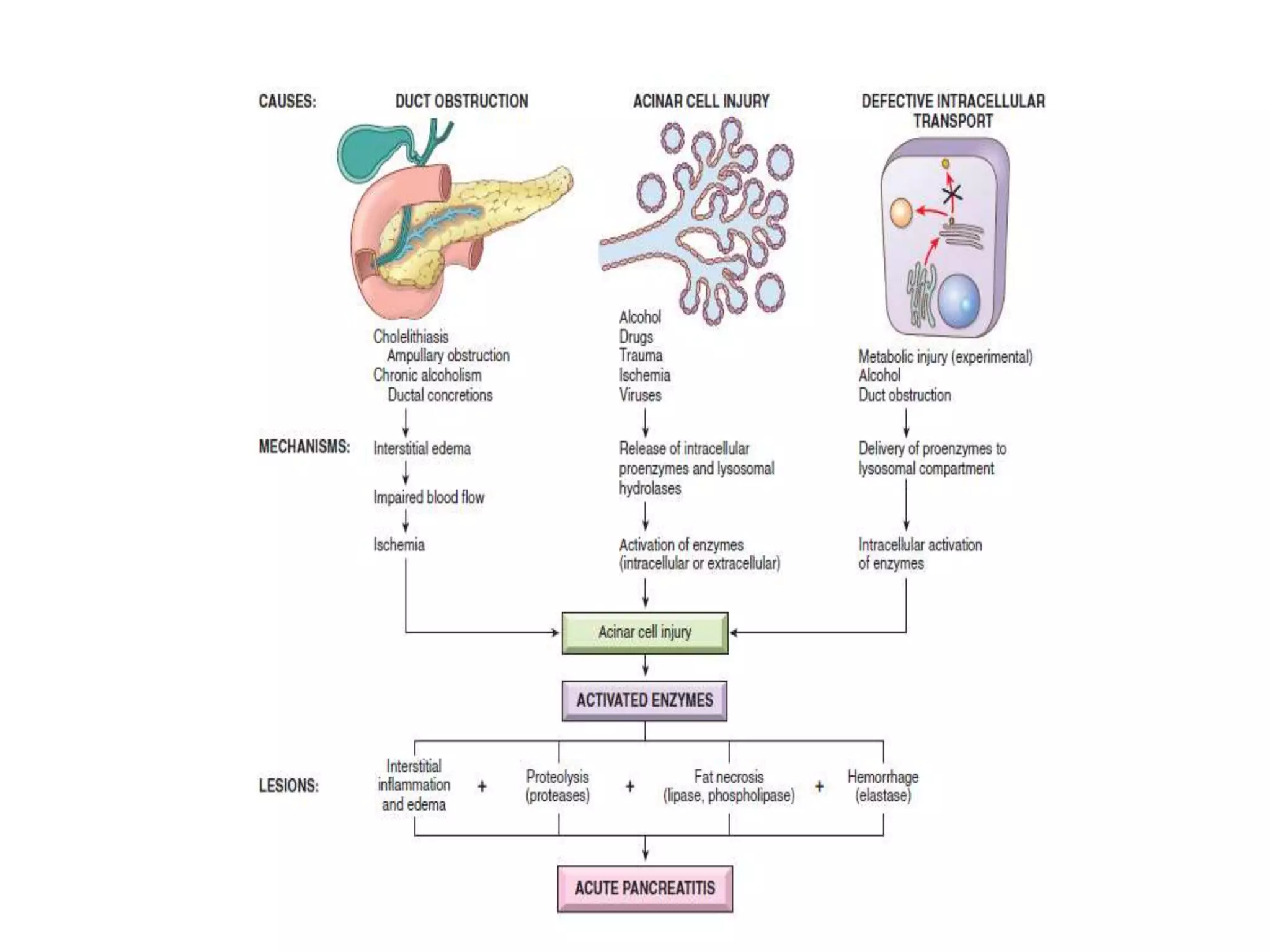 Pancreatitis | PPTX
