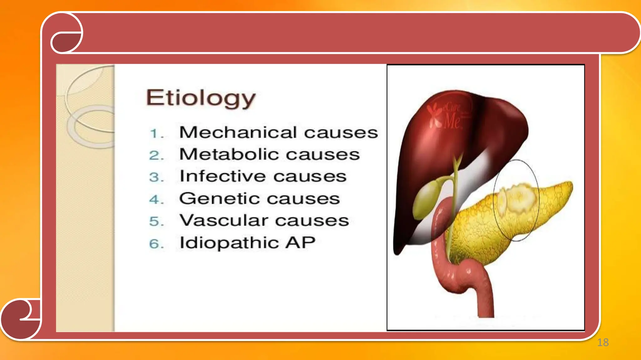 Pancreatitis-.pptx