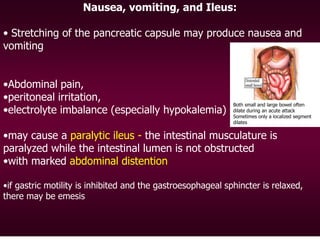 Pancreatitis.ppt