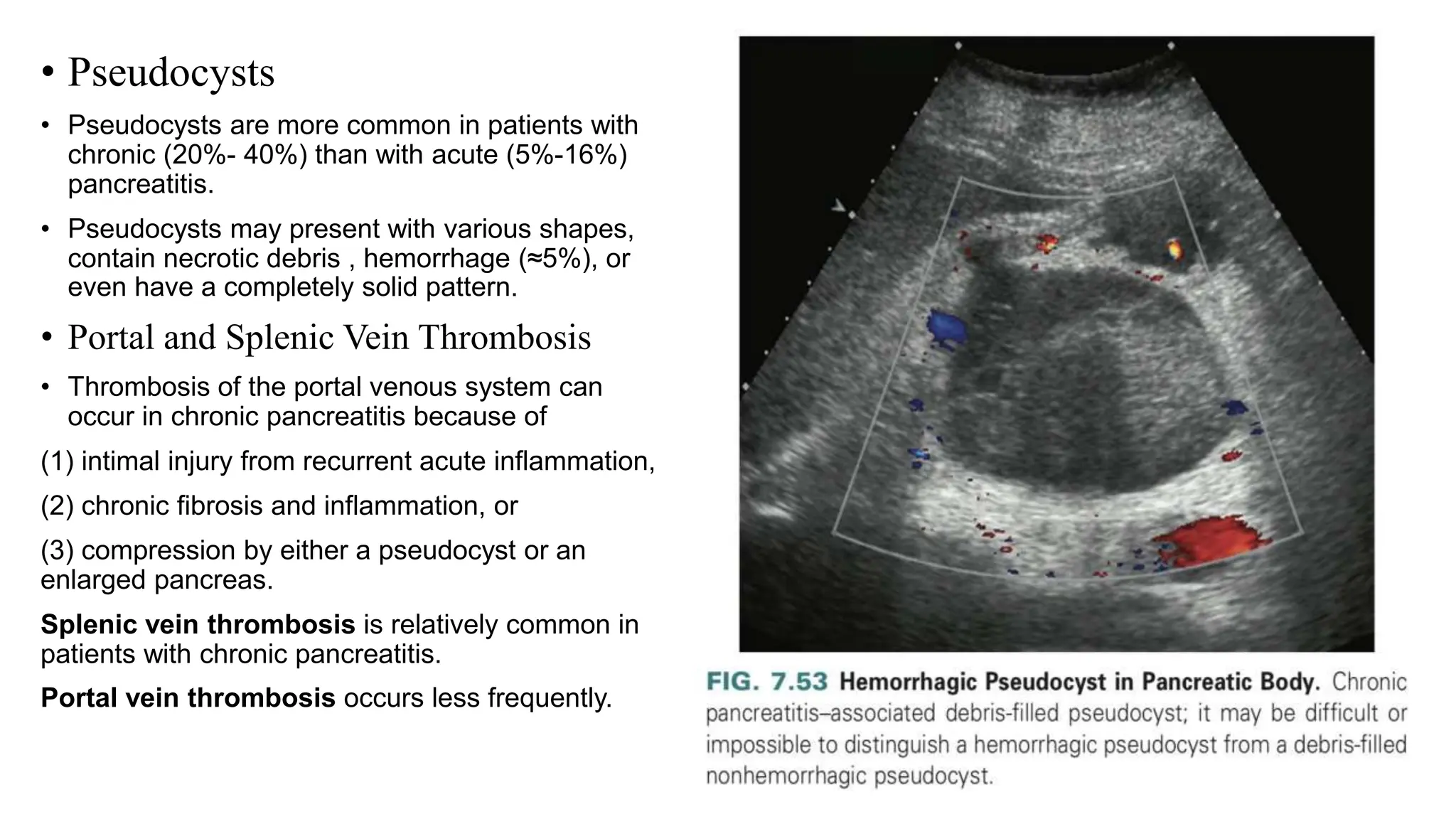 Sonological features of Pancreatitis.pptx