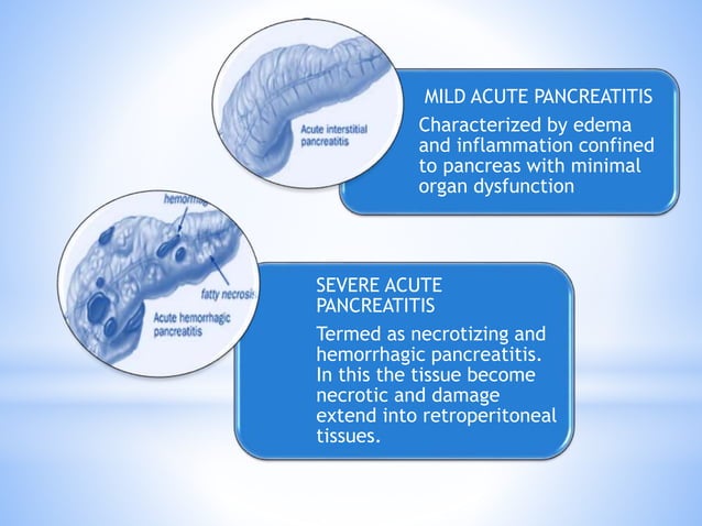 pancreatitis and its treatment and nursing management .pptx