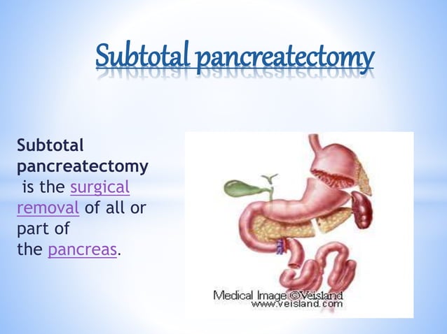 pancreatitis and its treatment and nursing management .pptx