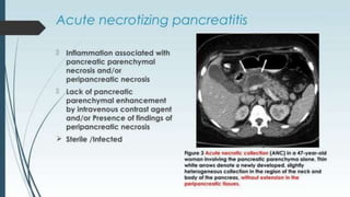 pancreatitis-presentation for nursing students | PPT