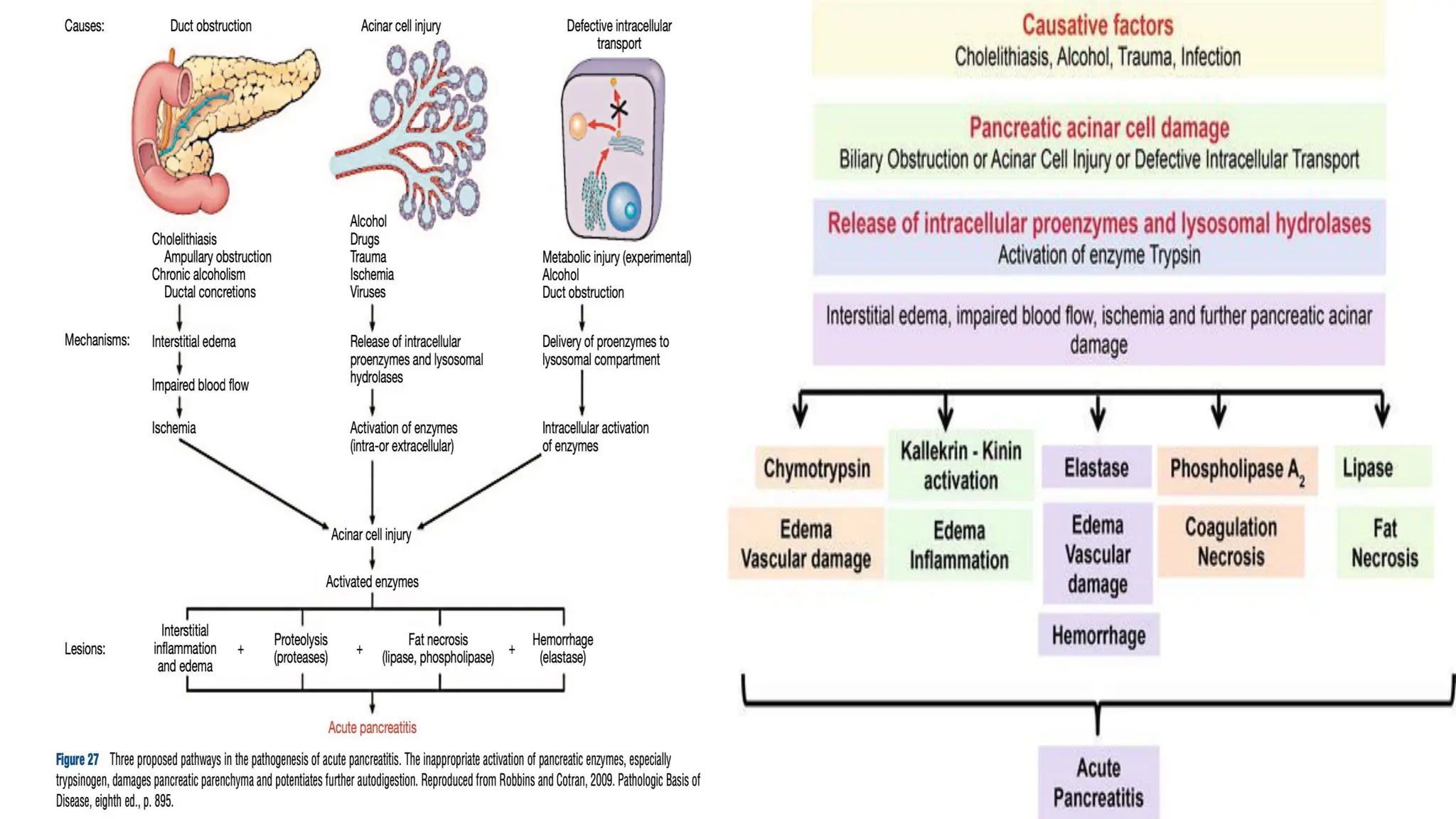 Pancreatitis - Acute & Chronic - Types, C/F & Mgt | PDF