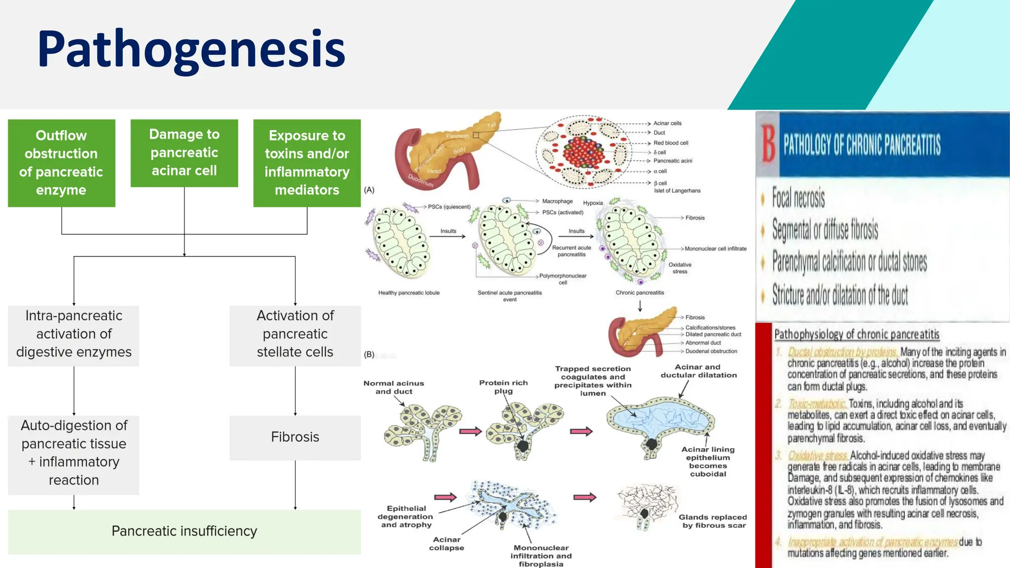 Pancreatitis - Acute & Chronic - Types, C/F & Mgt | PDF