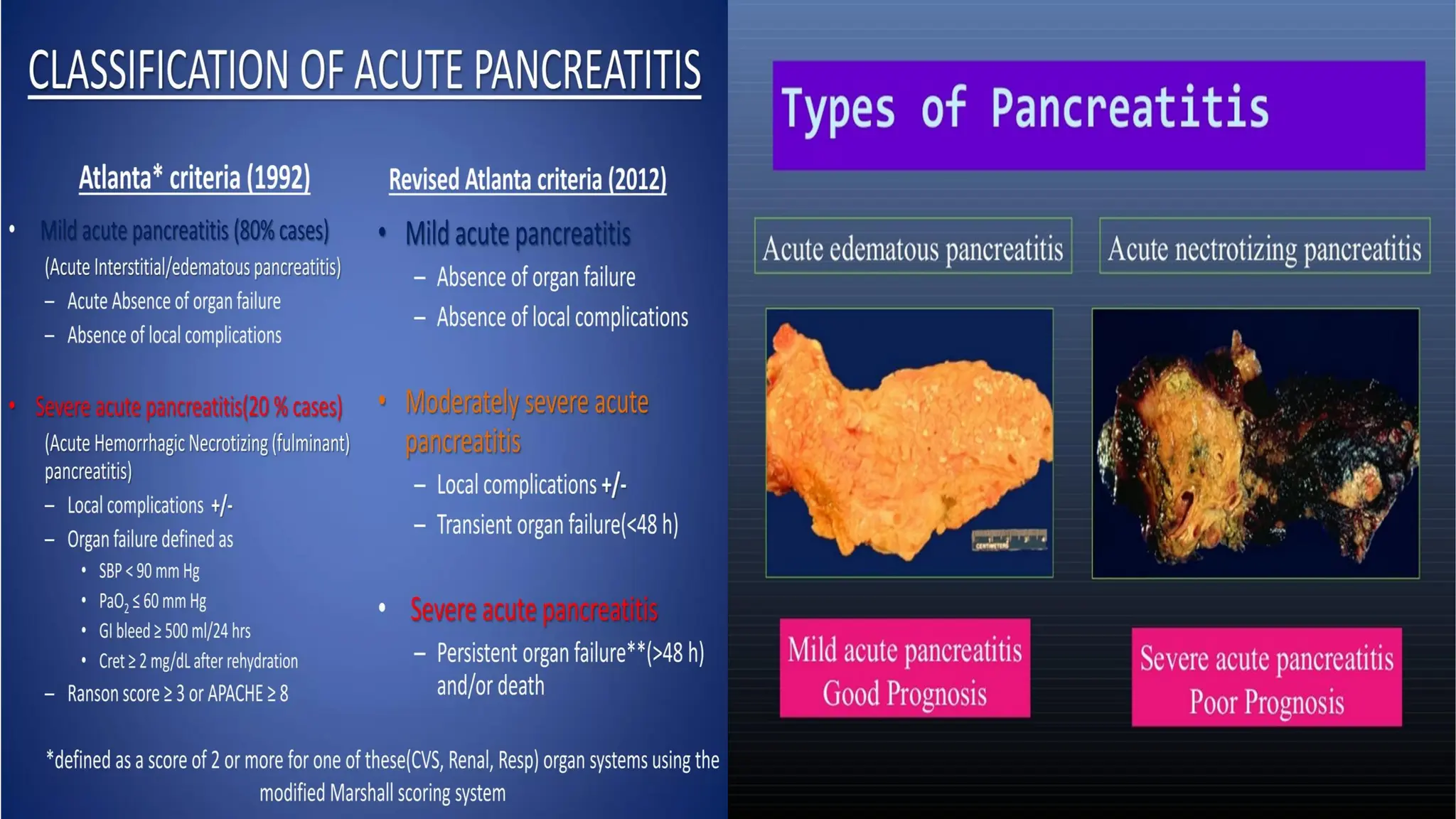 Pancreatitis - Acute & Chronic - Types, C/F & Mgt | PDF