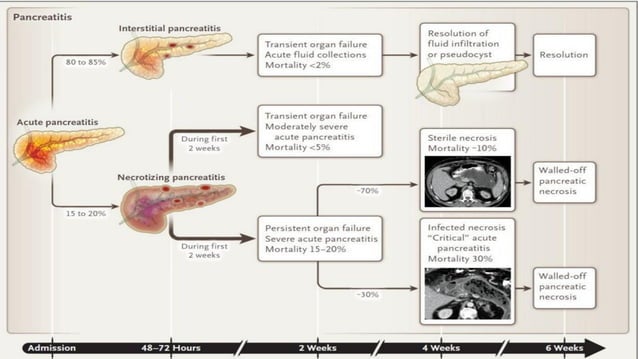 Pancreatitis - Acute & Chronic - Types, C/F & Mgt | PDF | Digestive ...