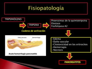 pancreatitis-pediatra.pptx | Digestive Disorders | Diseases and Conditions