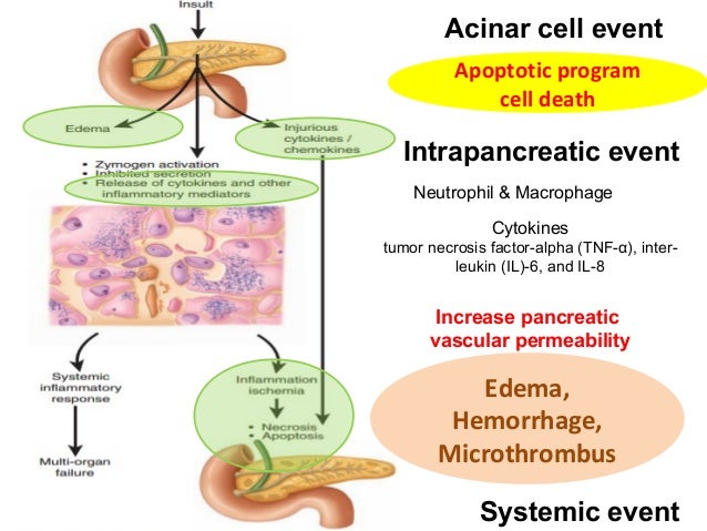 pancreatitis