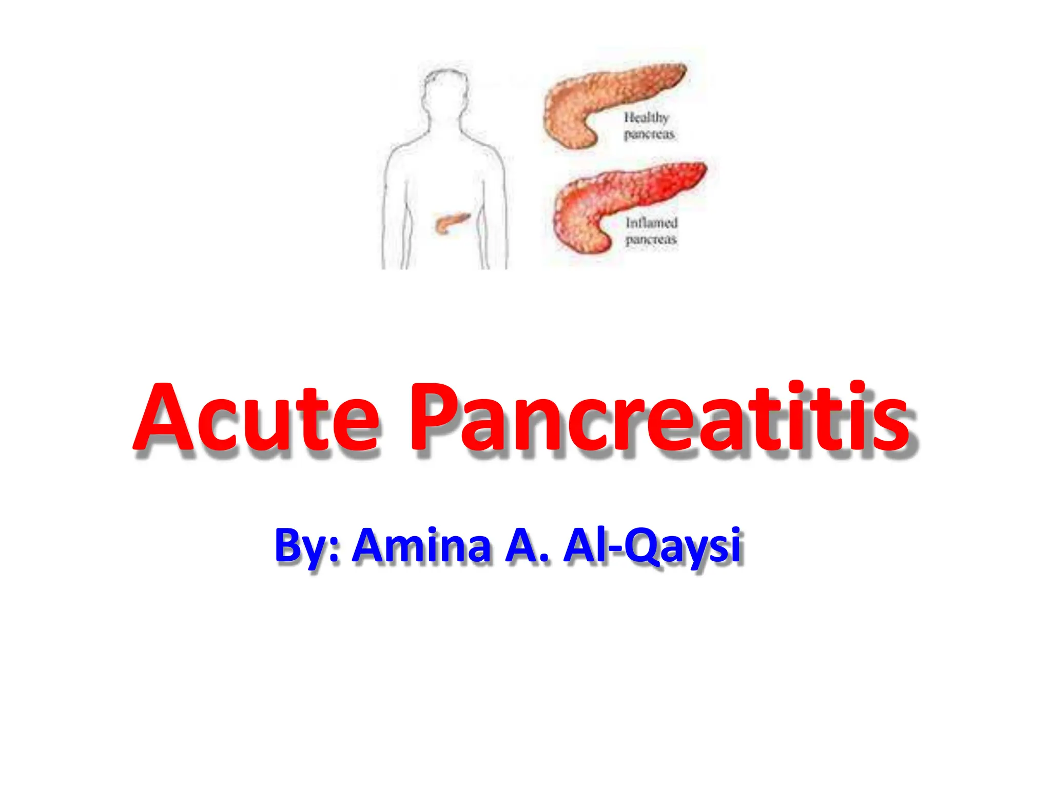 pancreatitis Gi disorder diagnosis management | PPT