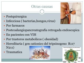Pancreatitis aguda | PPTX