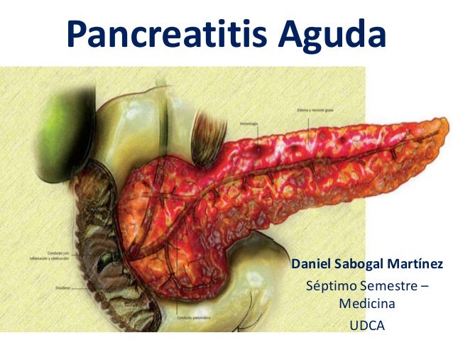 Pancreatitis Aguda Causas : Pancreatite aguda – JVCTIH