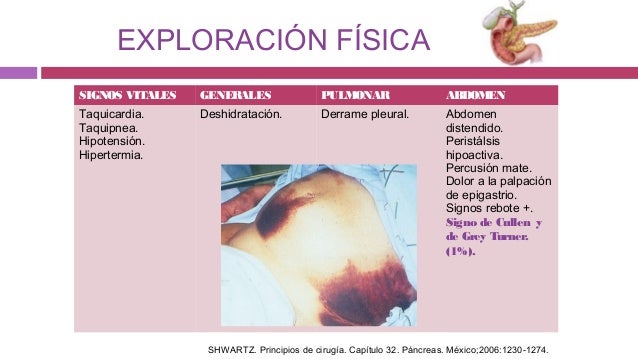 Pancreatitis aguda