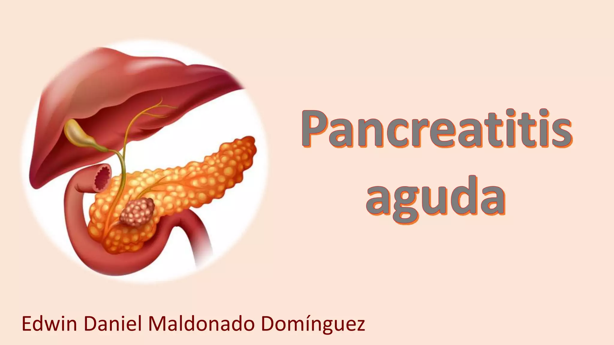 Pancreatitis Aguda | PPTX