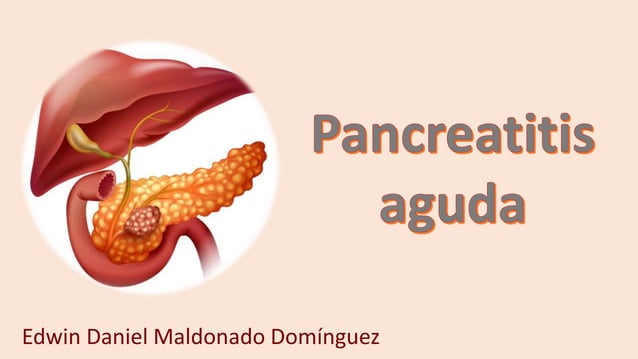 Pancreatitis Vector Illustration Cartoondealercom 82434604