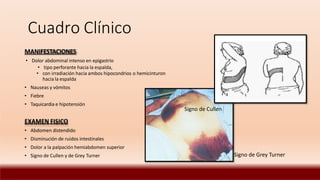 Pancreatitis Aguda.pptx