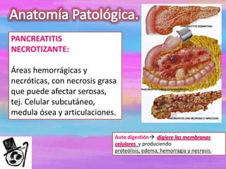 Pancreatitis aguda | PPT