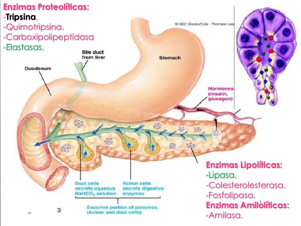 Pancreatitis aguda