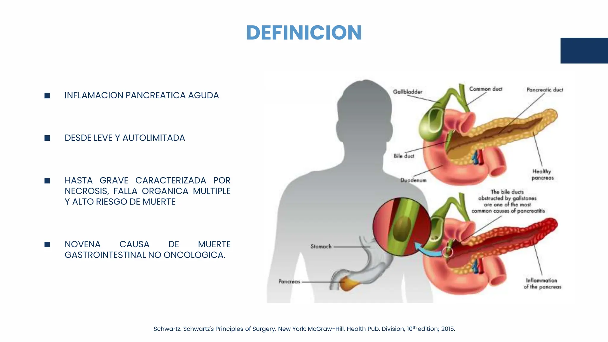 PANCREATITIS AGUDA, CONCEPTO, PRESENTACION CLINICA, DIAGNOSTICO Y ...