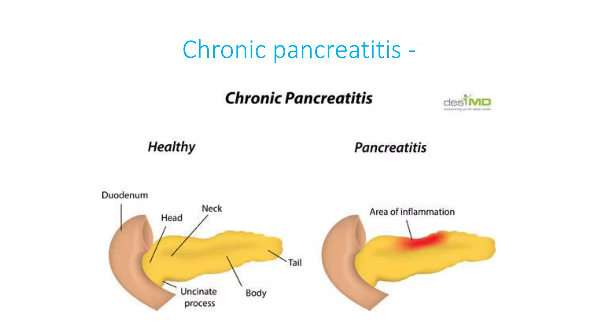 Pancreatitis and peritonitis | PPTX