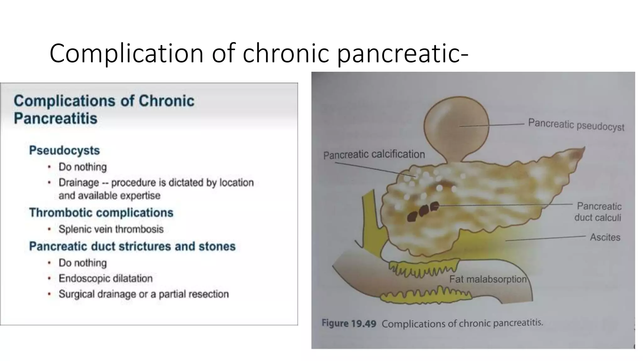 Pancreatitis and peritonitis | PPTX