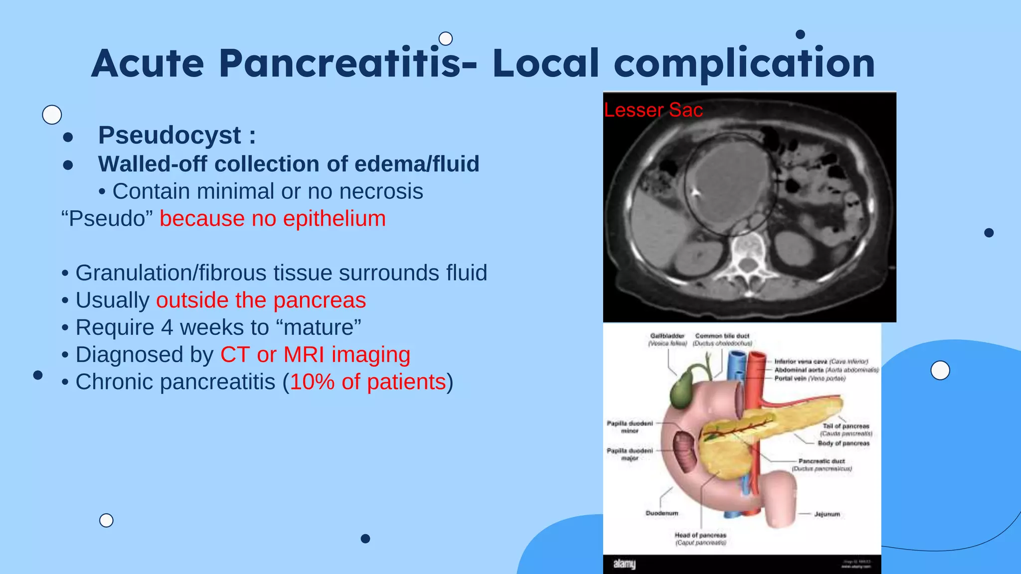 Pancreatitis Complications - pptx | PPT