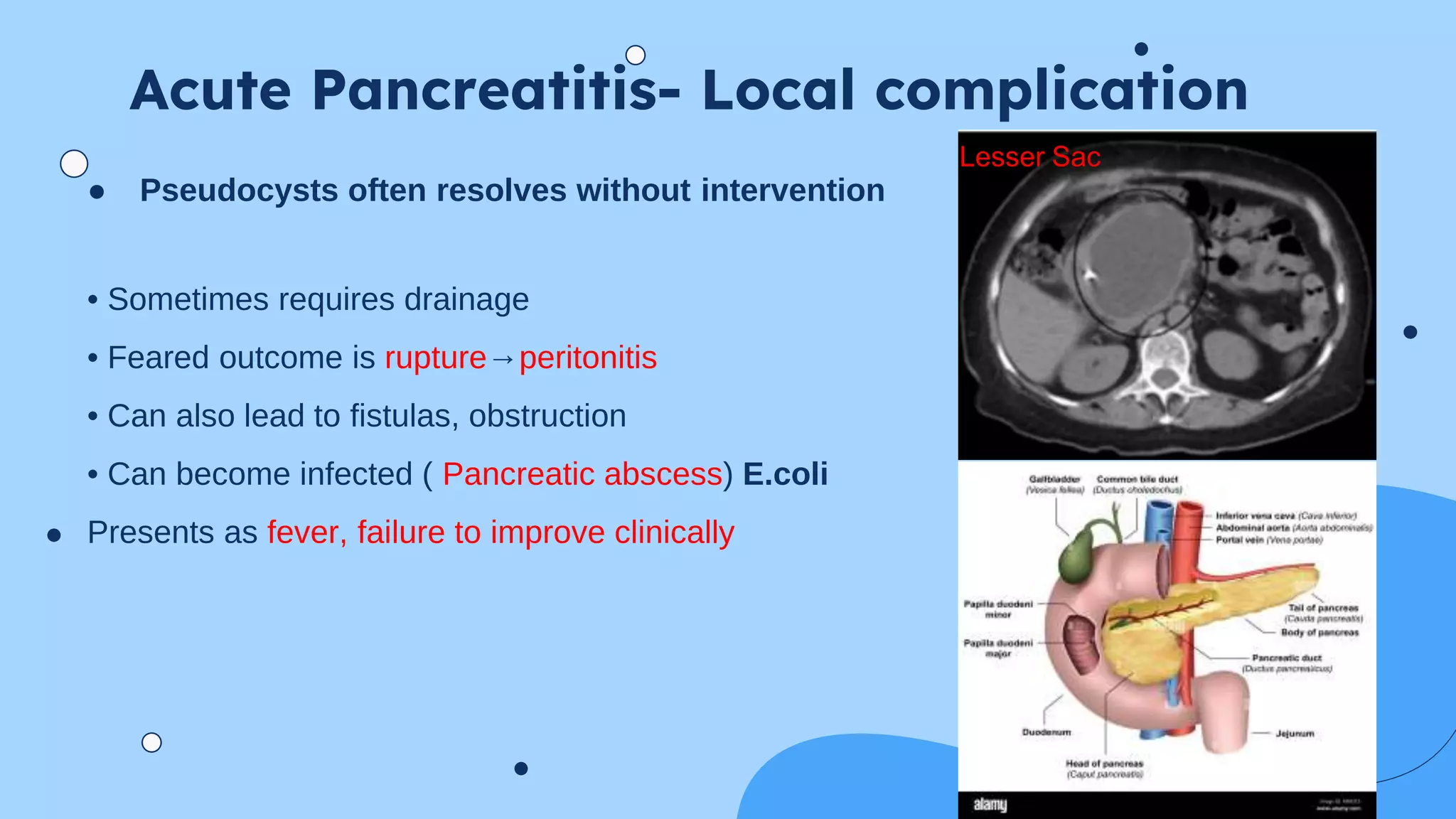 Pancreatitis Complications - pptx | PPT