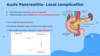 Pancreatitis Complications - pptx | PPT