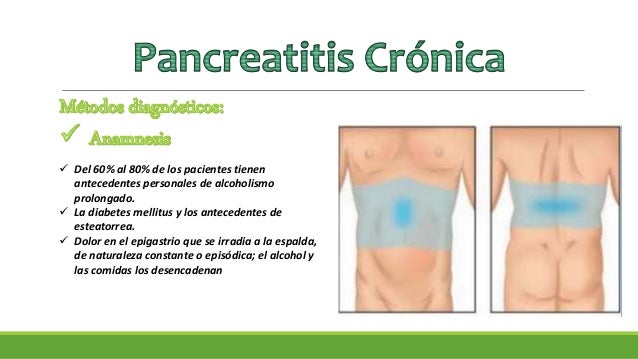 Pancreatitis cronica (CLINICA QUIRURGICA - UNERG)