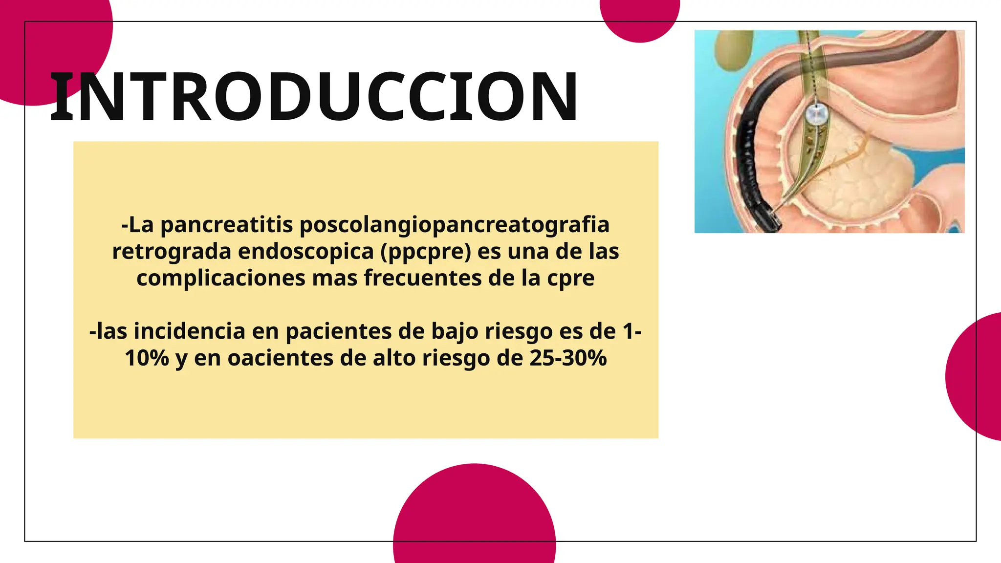 PROFILAXIS DE LA PANCREATITIS POSTERIOR A CPRE | PPTX