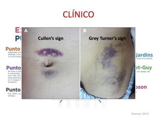 Pancreatitis Diagnóstico y Tratamientlx.pptx