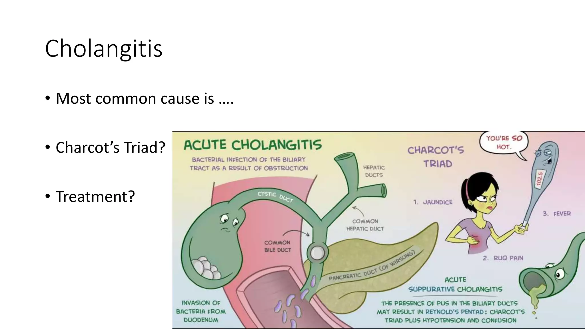 Pancreatitis and its Complications, and Acute Cholangitis | PPTX