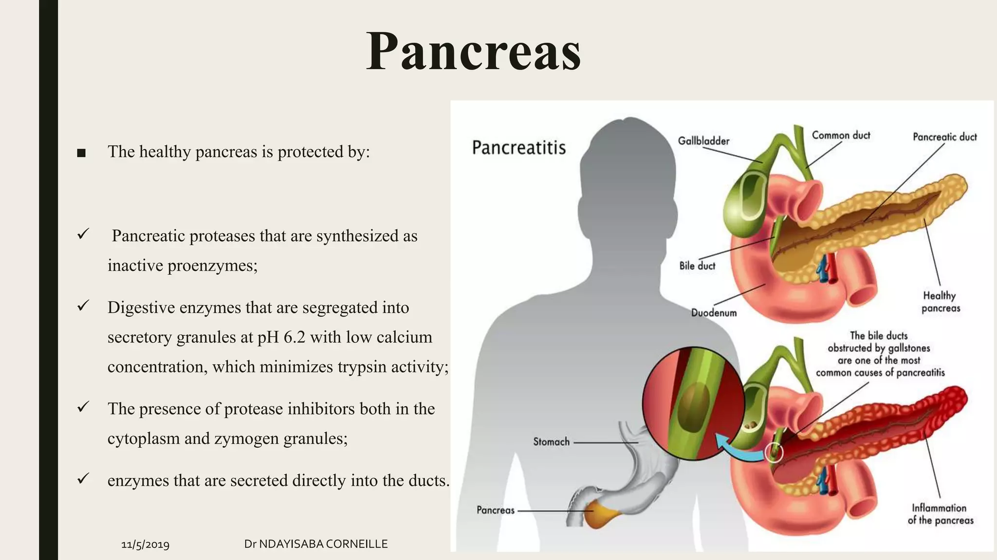 Pancreatitis in pediatrics | PPTX
