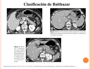 Pancreatitis aguda, clasificacion, dianostico y tratamiento. | PPTX