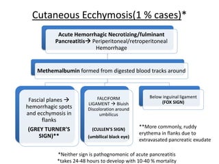 Acute Pancreatitis (According to American College of Gastroenterology ...