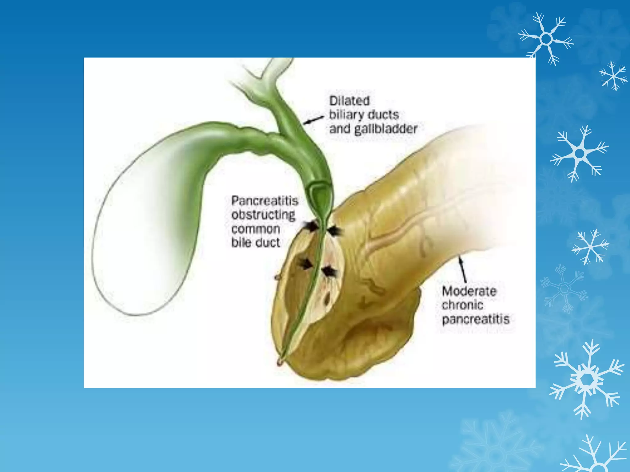 Pancreatitis ppt nitin 1st msc nursing | PPTX