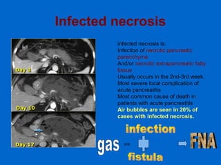 Pancreatitis scoring and terminology | PPT