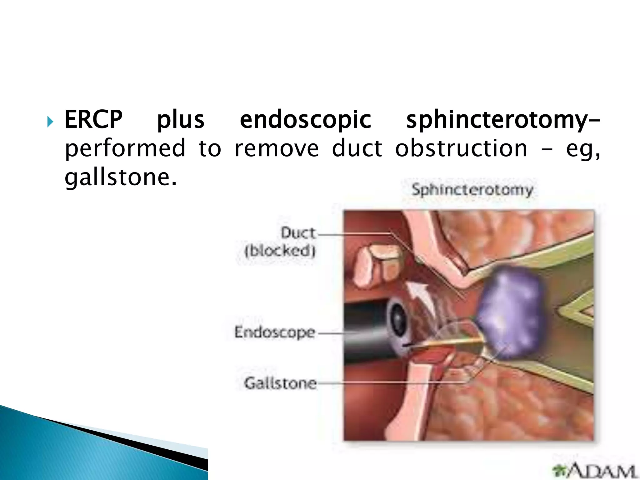 ACUTE AND CHRONIC PANCREATITIS | PPTX