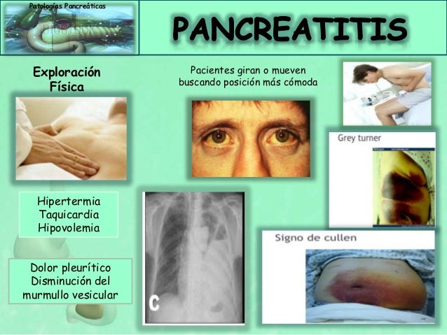 Pancreatitits