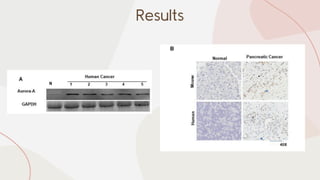 Pancreatology - Molecular Biology - Isabella Pel%C3%A1ez C.pdf