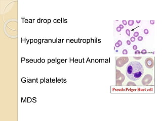 pancytopenia-170119201048.pdf | Blood Disorders | Diseases and Conditions