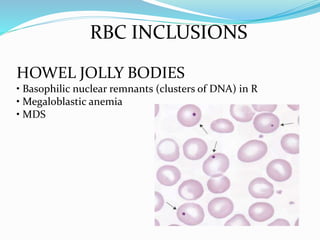 APPROACH TO PANCYTOPENIA | PPTX