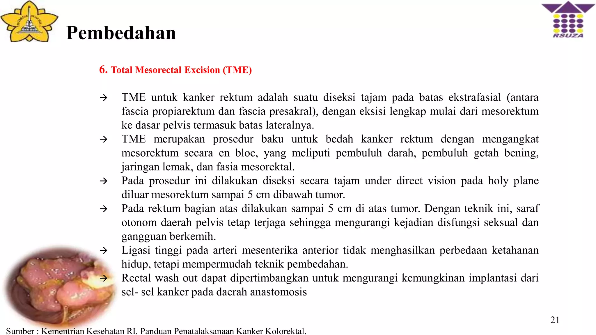 Panduan Penatalaksanaan Kanker Kolorektal_Zamra Sirakawa.pptx