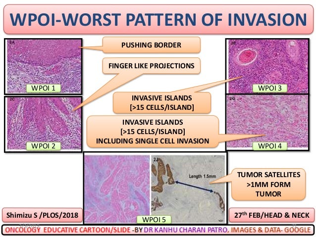 PANEL DISCUSSION- CANCER TONGUE