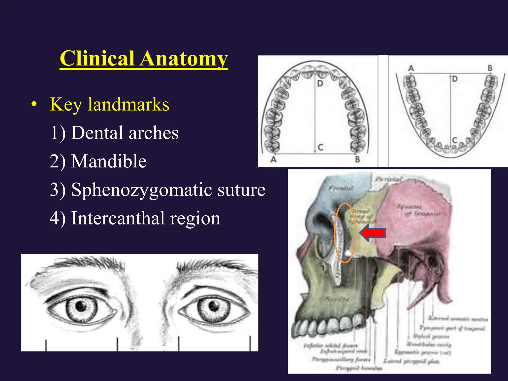 panfacial fractures- anatomy, clinical features, radiology.pptx