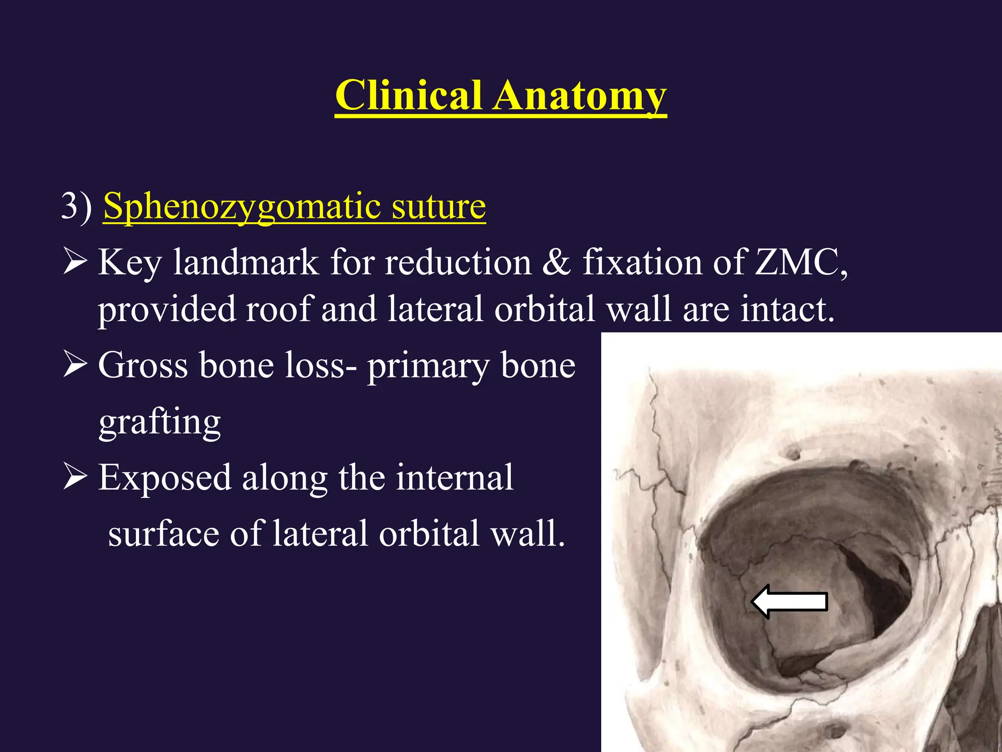 panfacial fractures- anatomy, clinical features, radiology.pptx