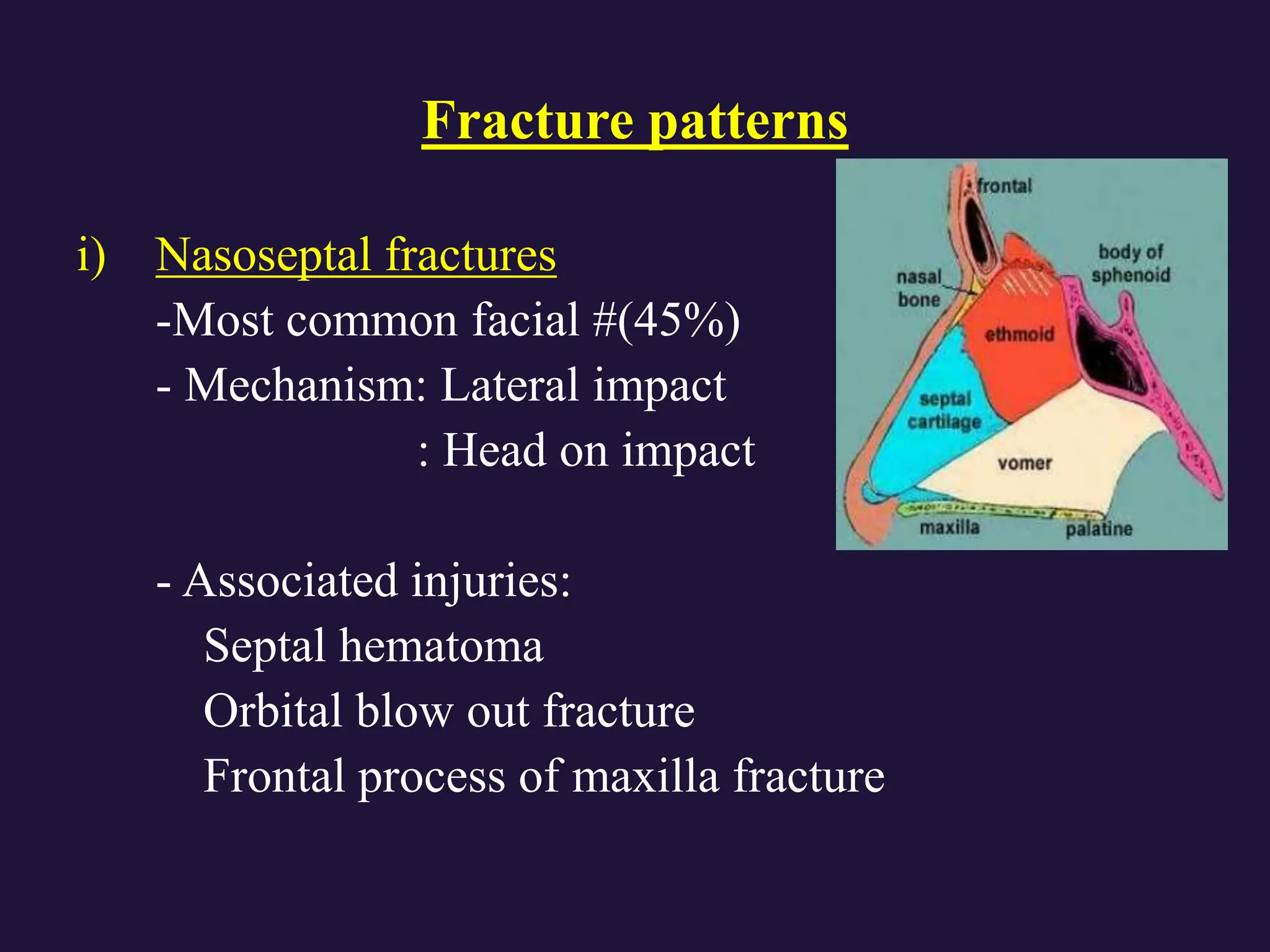 panfacial fractures- anatomy, clinical features, radiology.pptx