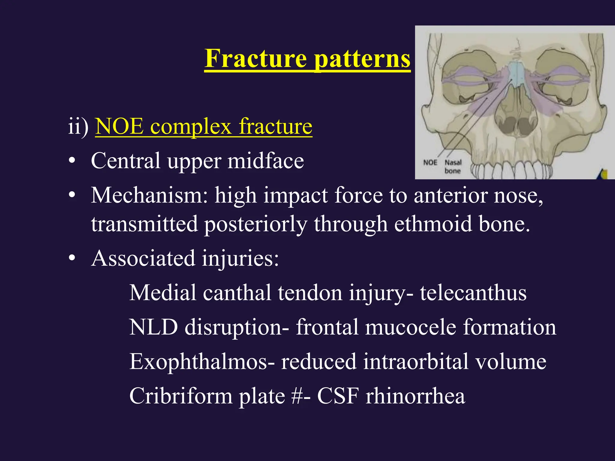 panfacial fractures- anatomy, clinical features, radiology.pptx